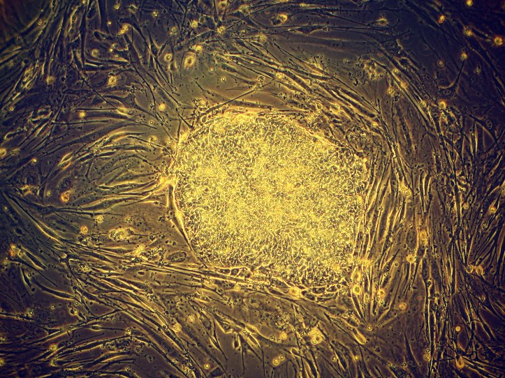 Daniel Aum – Heart of Flesh Literary Journal